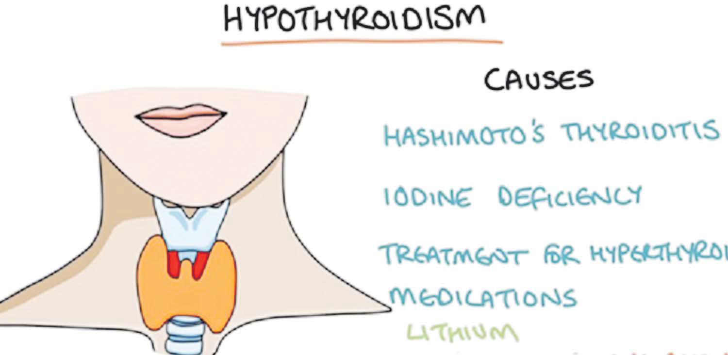 What is hypothyroidism - The Fiji Times