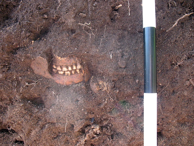 Human jaw uncovered dates back 2500-3100 years ago - The Fiji Times