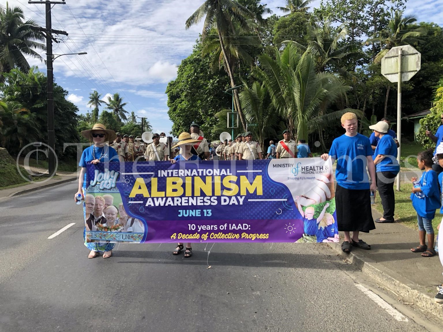 Albinism community play a vital role in society