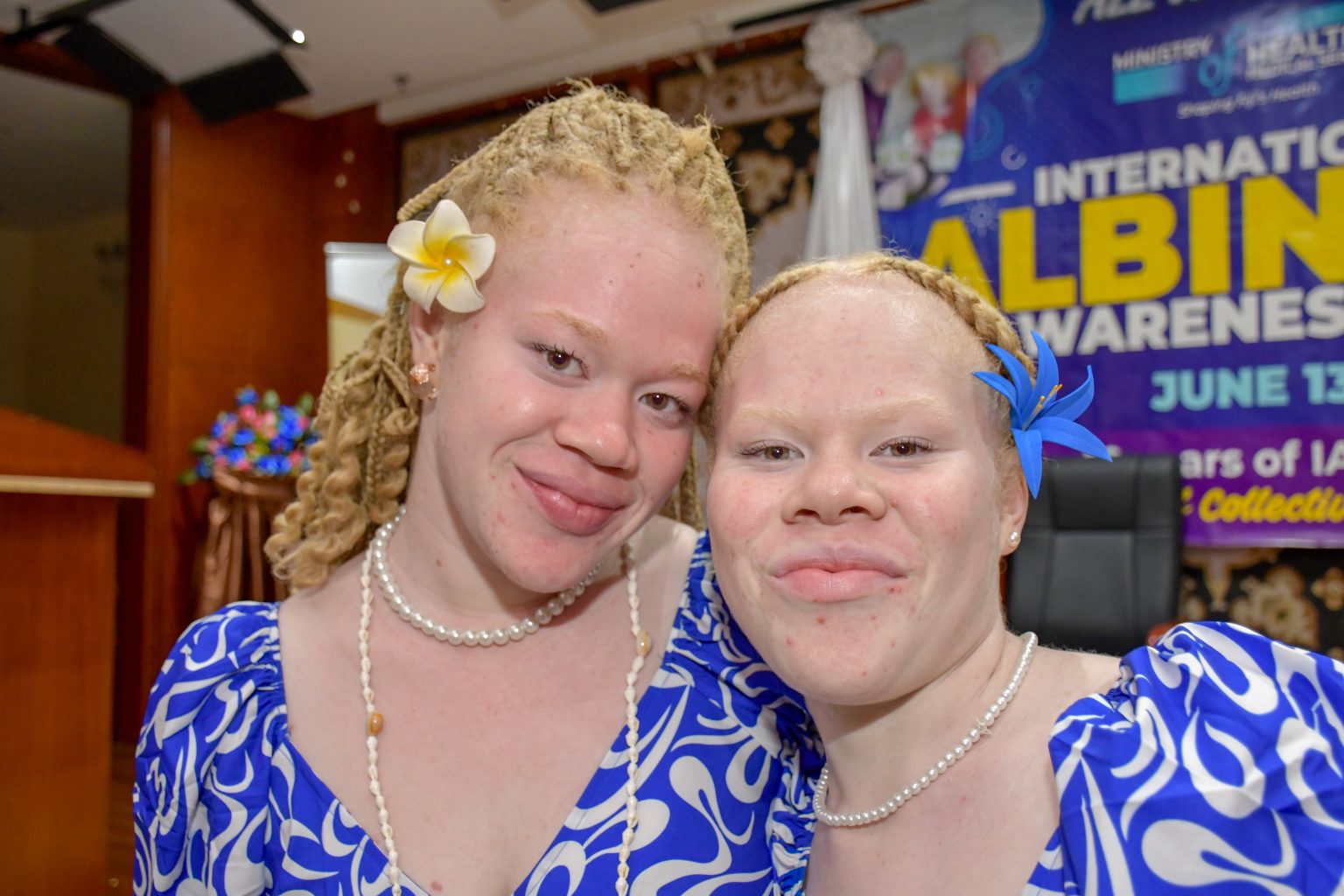 Fiji leads the way for albinism awareness - The Fiji Times